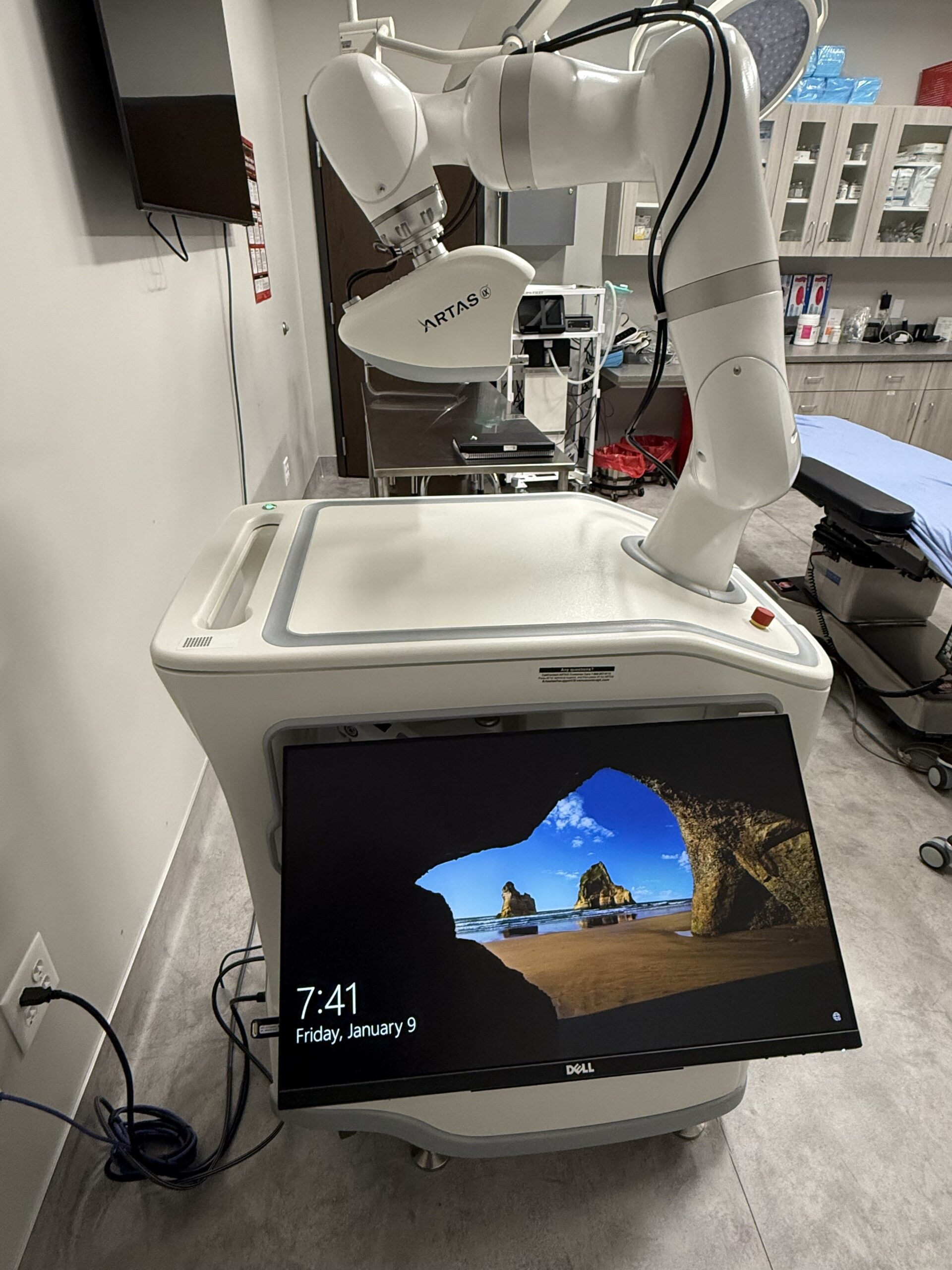 Lumenis Moses Pulse 120H Laser Machine - SALE